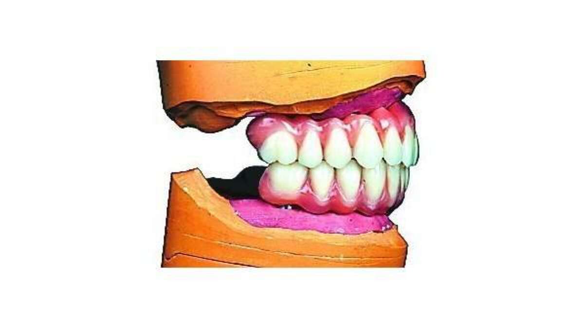 Neues Gebiss in nur drei Stunden