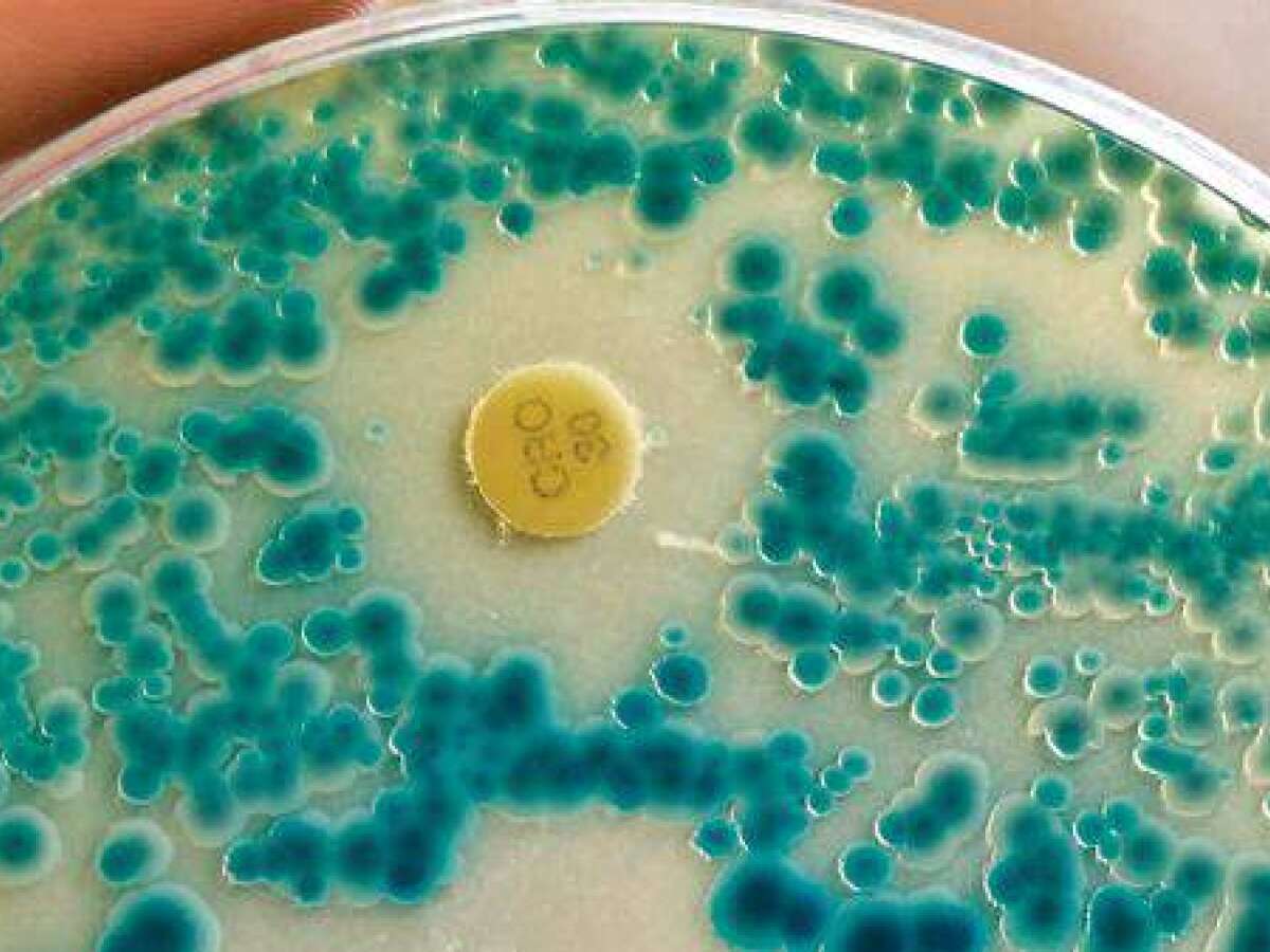 Das sollten Sie jetzt über multiresistente Keime wissen