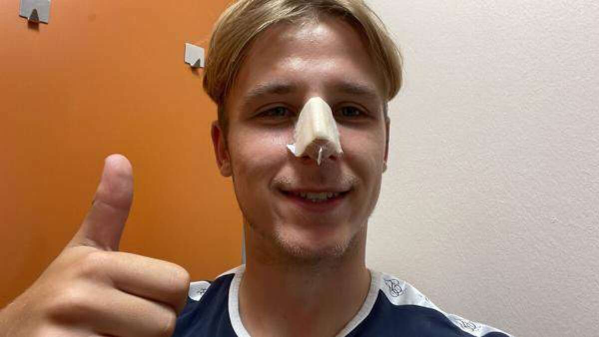 Nase von Brian Wienekamp nach Bruch gerichtet