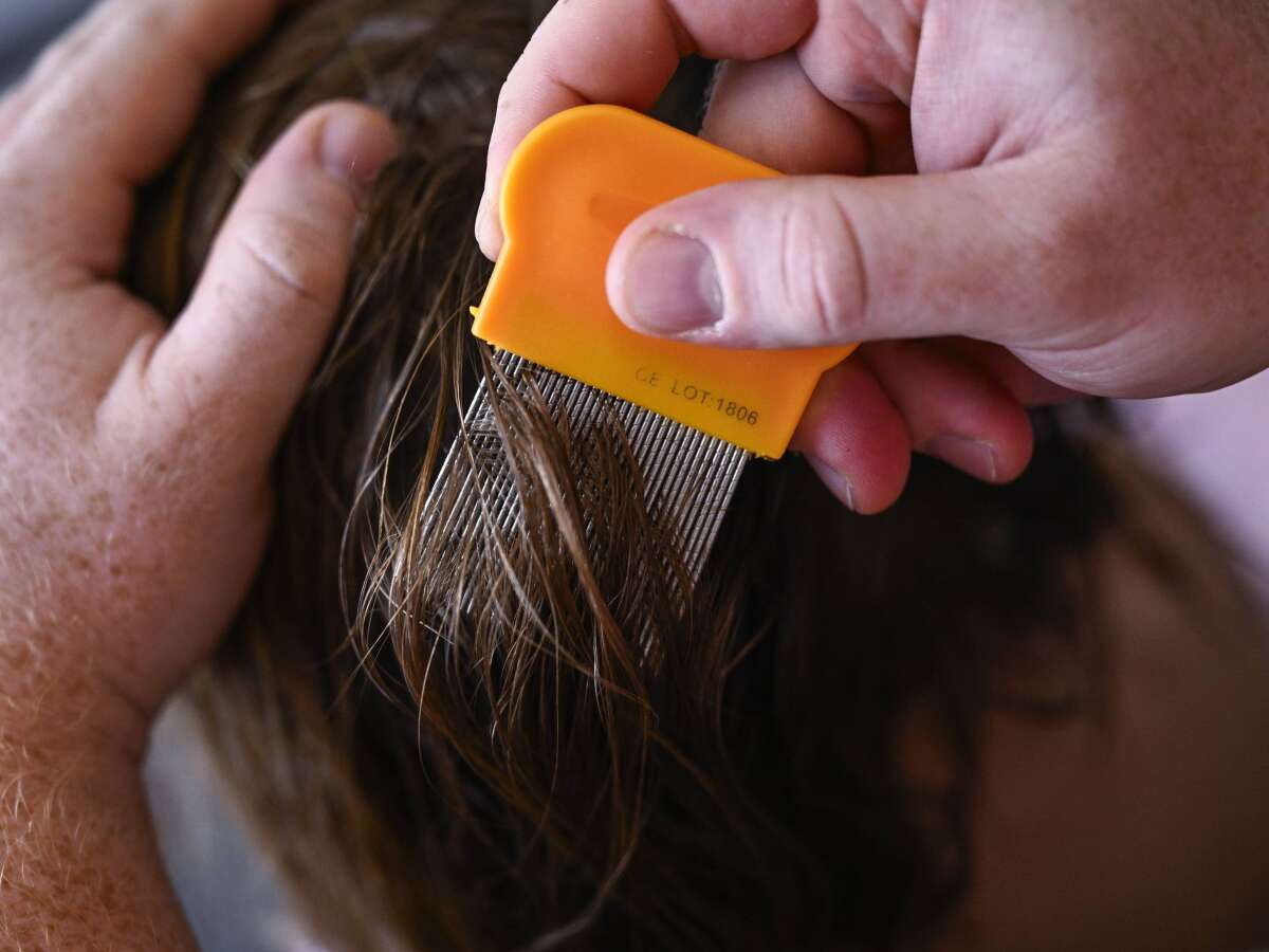 Kopfläuse behandeln: So werden Sie Kopfläuse wieder los – Tipps von der ...
